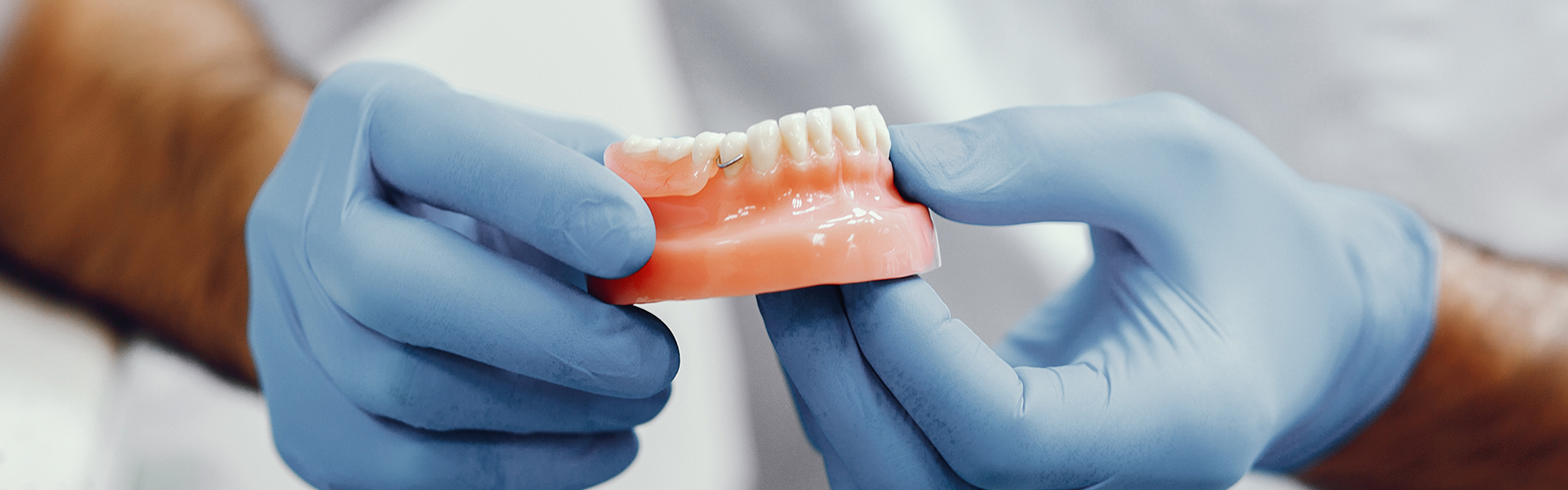 Types of Dental Bridges Explained: Which One Fits Your Needs?