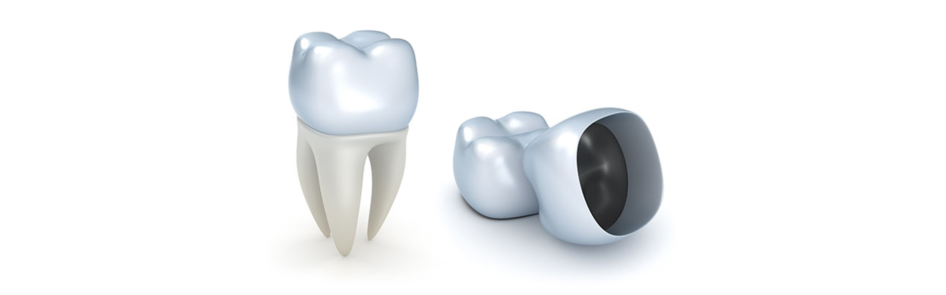 How Dental Crowns Protect and Strengthen Damaged Teeth?
