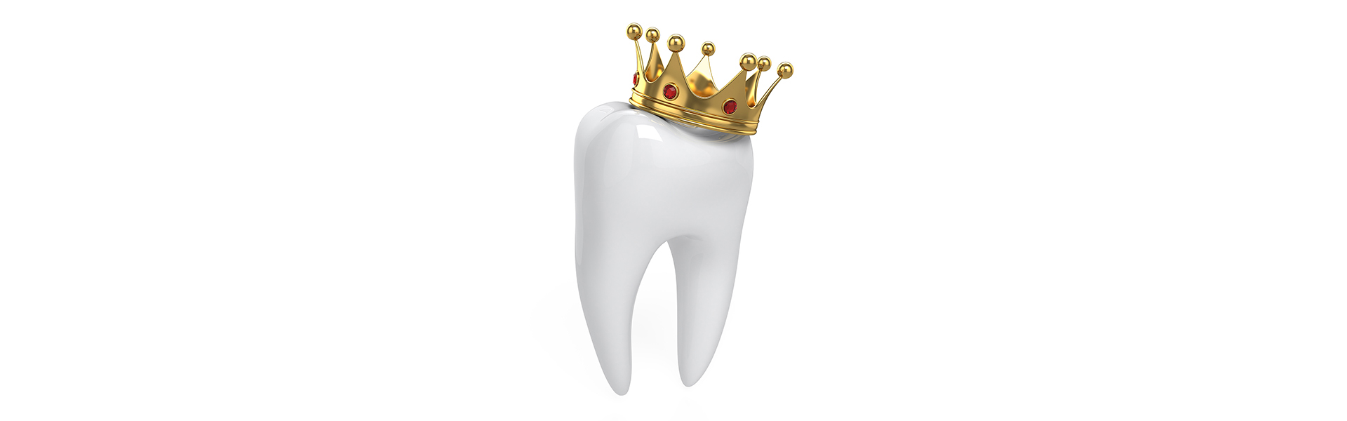 The Process of Getting Front Tooth Crowns: What to Expect